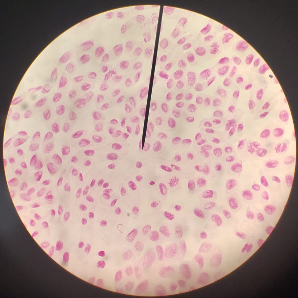Mitosis allium root tip squash, Onion Root Tip Squash prepared slides