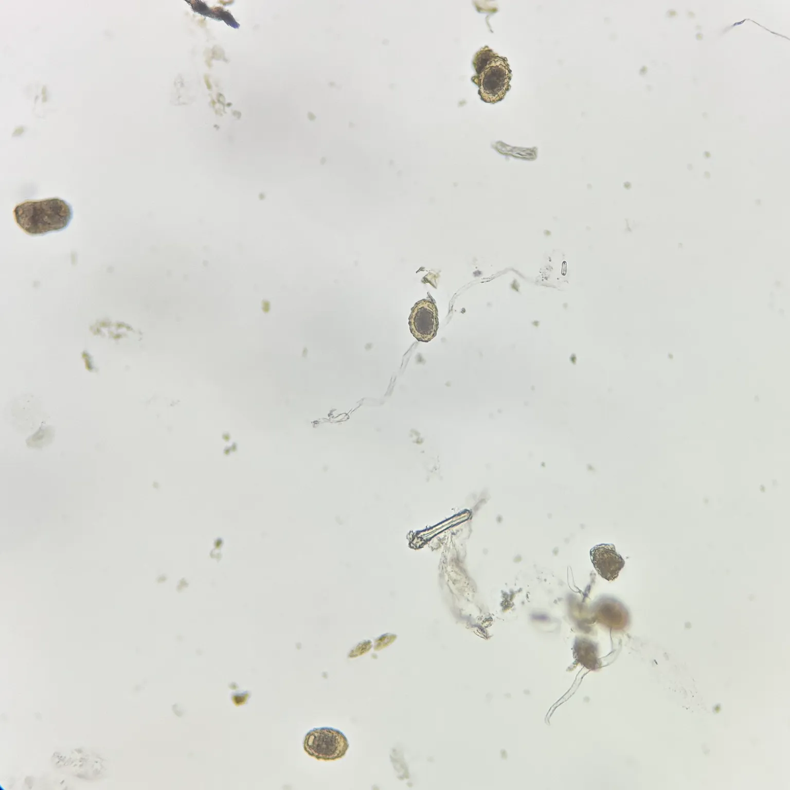 Ascaris lumbricoides Fertilized Ova Microscope Slide, 100% Clarity of ...